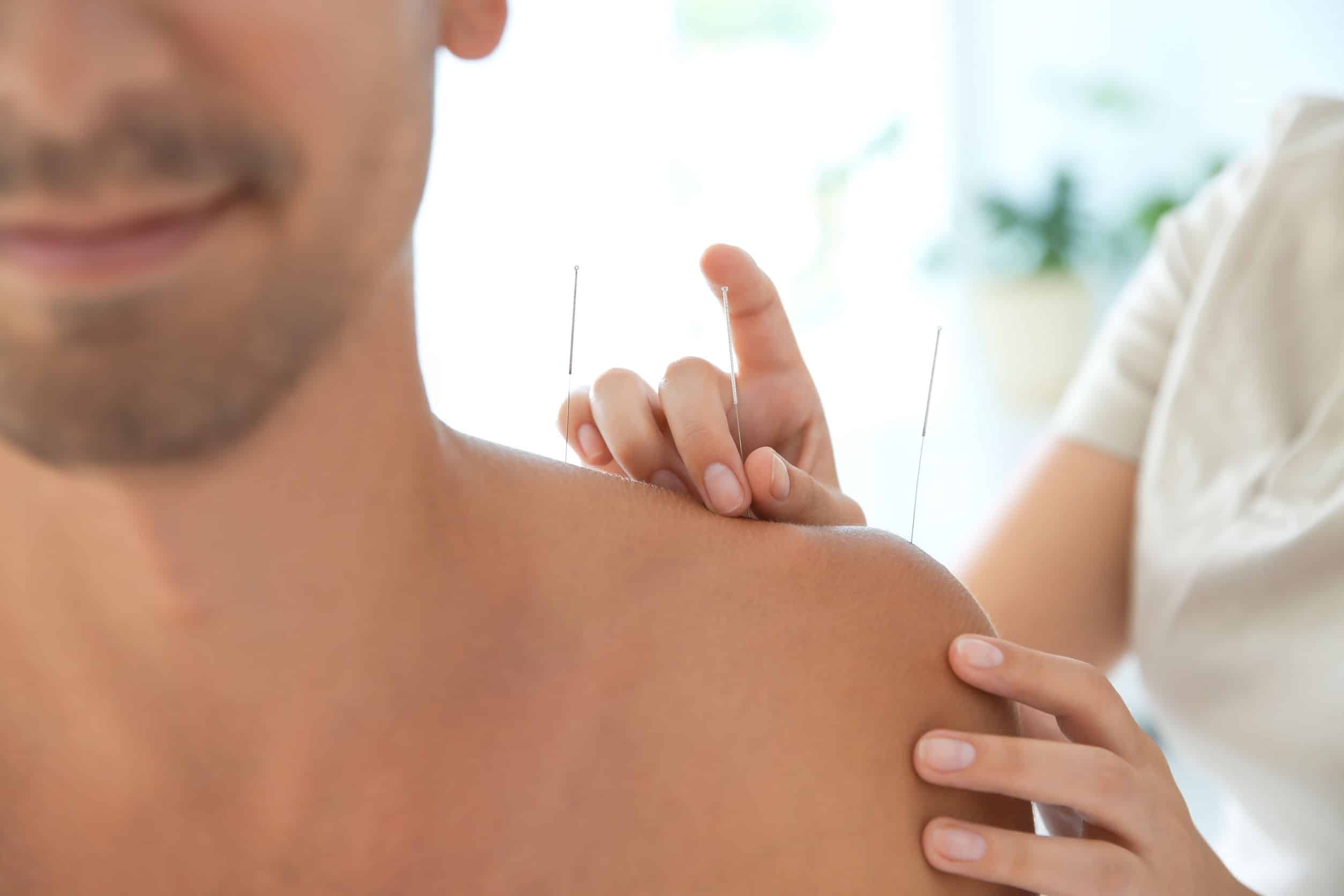 Maplebrook Acupuncture | Individual Acupuncture